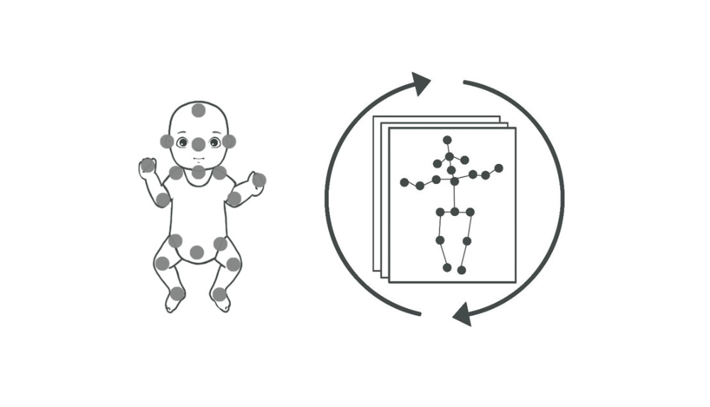 Early diagnosis of cerebral palsy: General Movement Assessment - NTNU